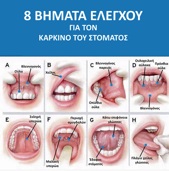 Όγκοι κεφαλής και τραχήλου - Δρ. Νικόλαος Σ. Κεχαγιάς